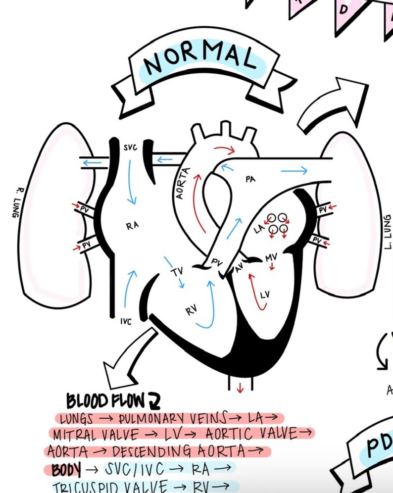 Normal Circulation + PDA/PFO: Nicu Nursing & Nnp Notes - Etsy