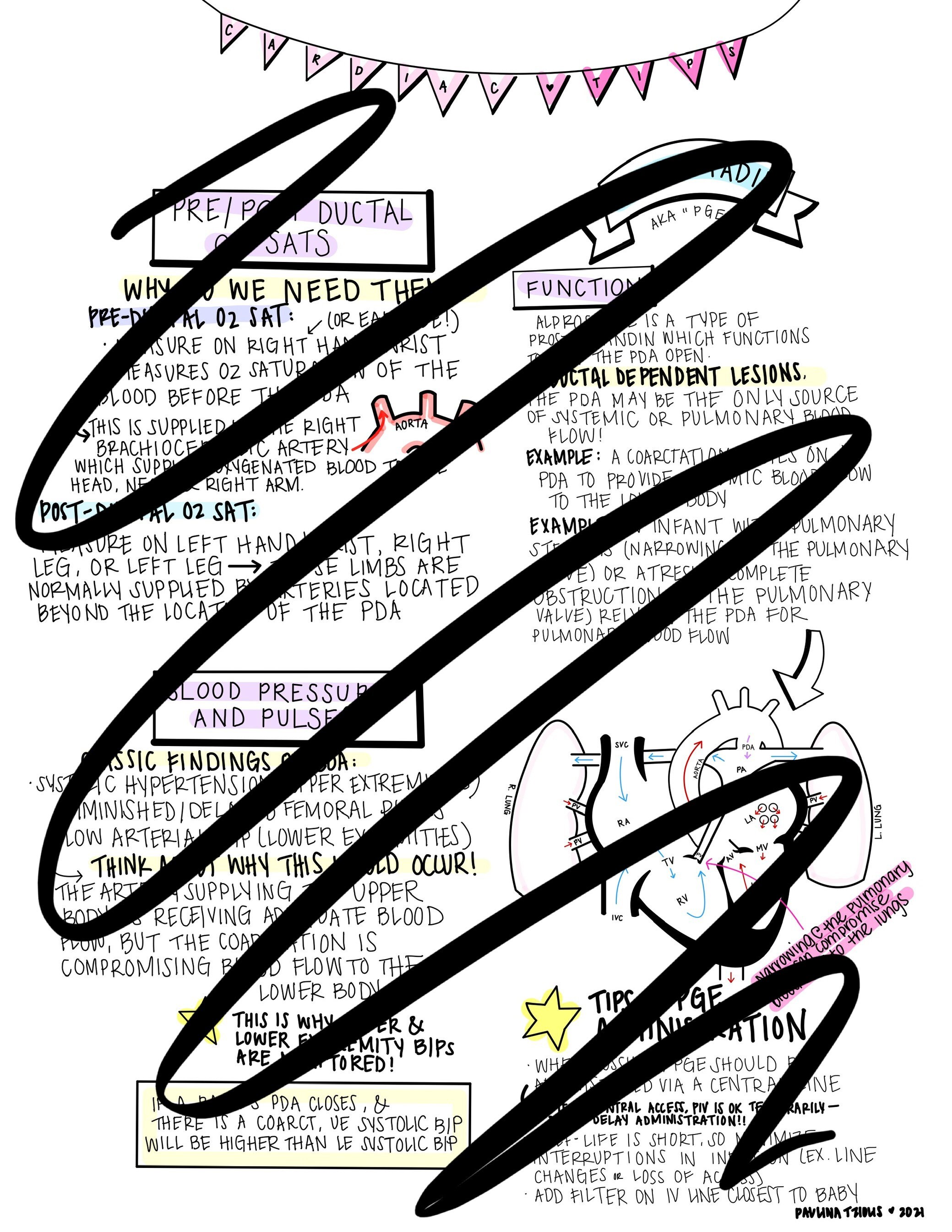 PDA + Alprostadil : Nicu Nursing & Nnp Notes - Etsy