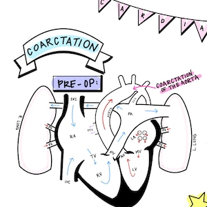 Coarctation + TGA With IVS (pre/post Op) : Nicu Nursing & Nnp Notes - Etsy