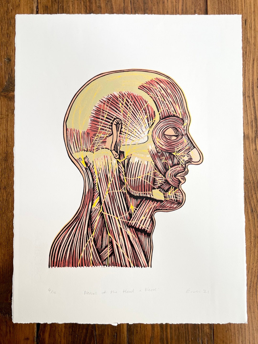Head and Neck Anatomy Linocut Print - Etsy