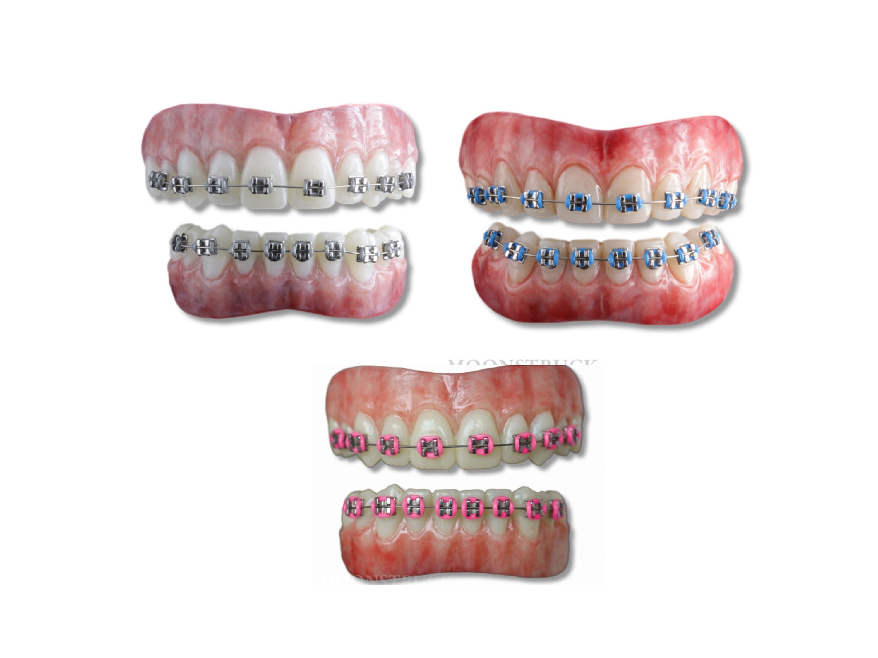 Winter Blue Braces For Teeth