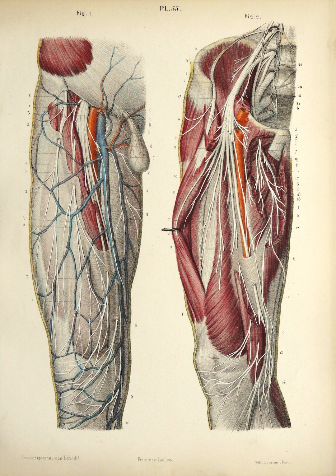 1867 Antique Engraving of HUMAN ANATOMY. PHYSIOTHERAPY. Legs. Surgery ...