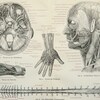 1897 Antique Print of ANTHROPOLOGY, MEDICINE: Physiognomy of Different ...