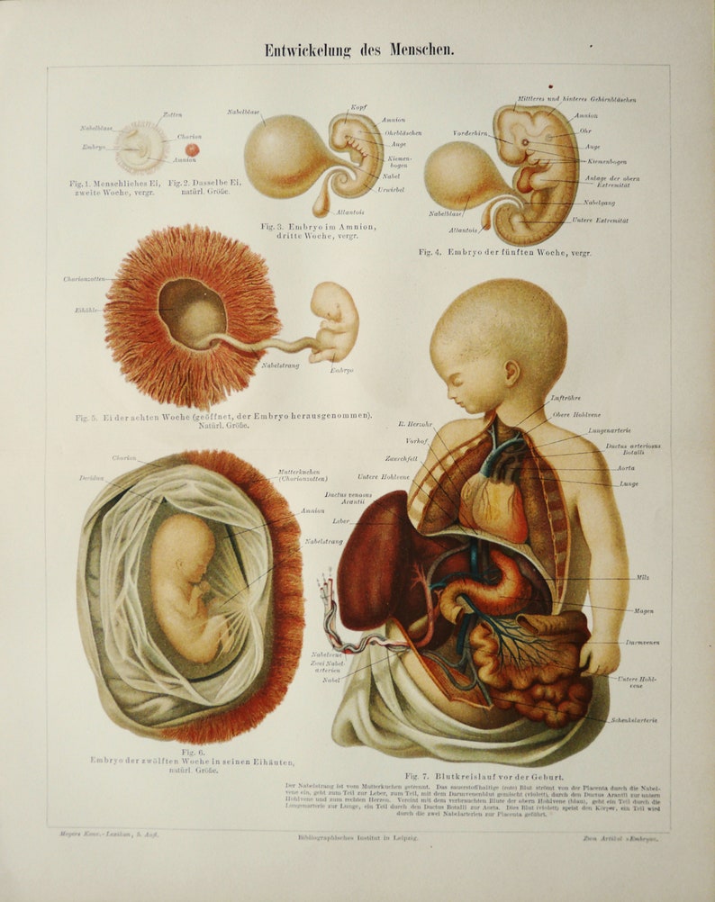 1897 Antique Lithograph of FEMALE ANATOMY. Ginecology. - Etsy