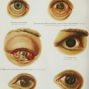 1897 Antique Bizarre Lithograph of OPHTHALMOLOGY: HUMAN EYES. Eyeball ...