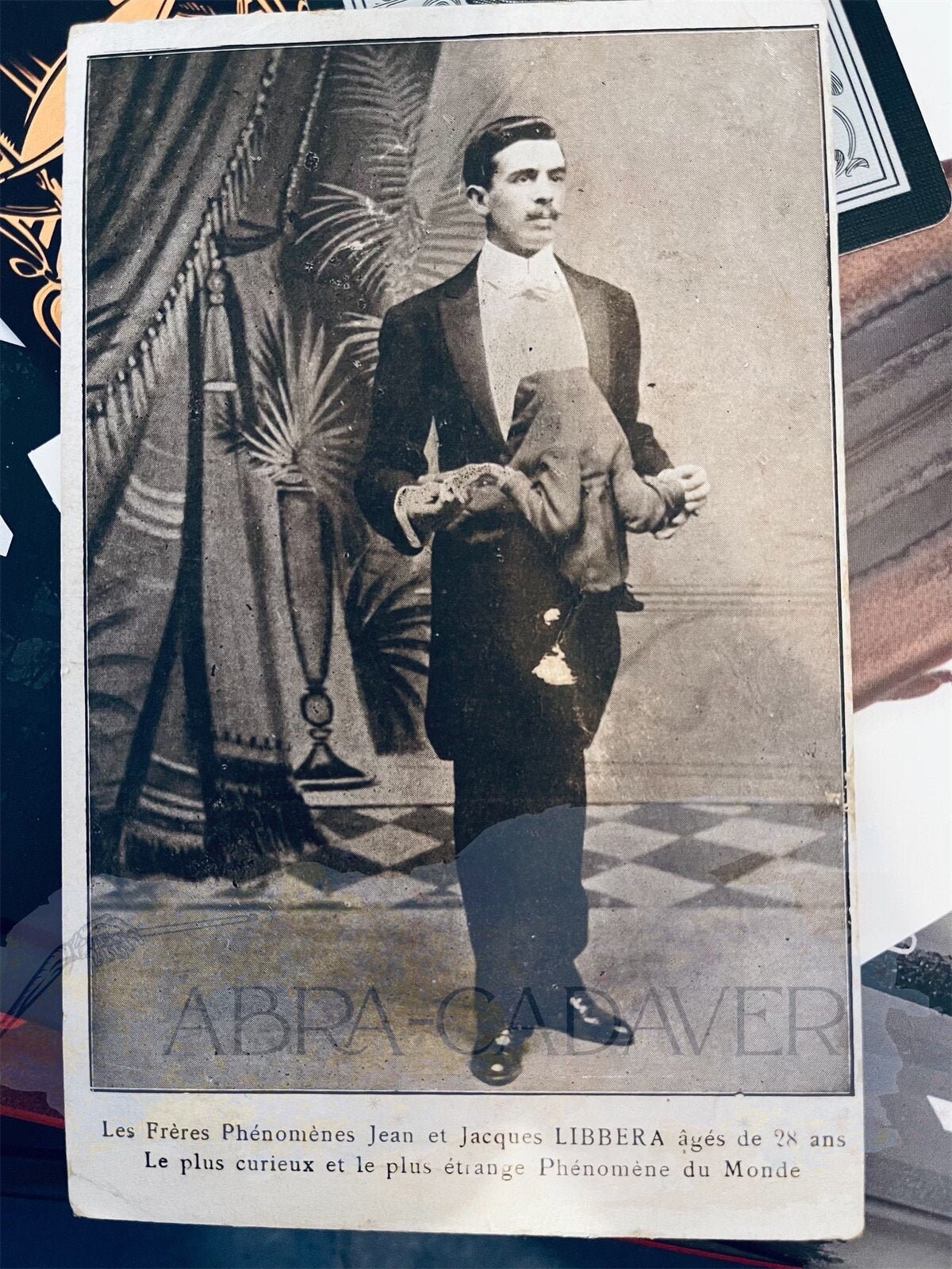 Antique Postcard Jean Libbera and his parasitic twin | Etsy
