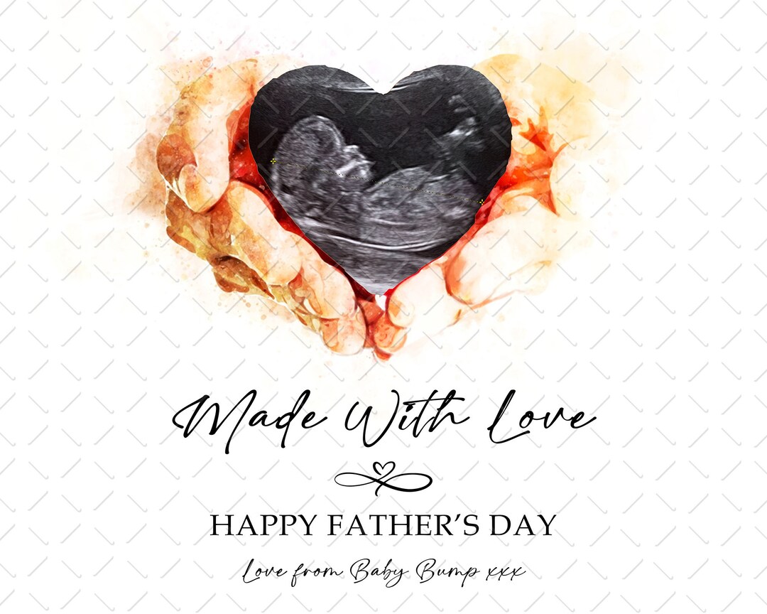 Expecting Dad Png, 1st Fathers Day Baby Ultrasound Photo Png, First ...