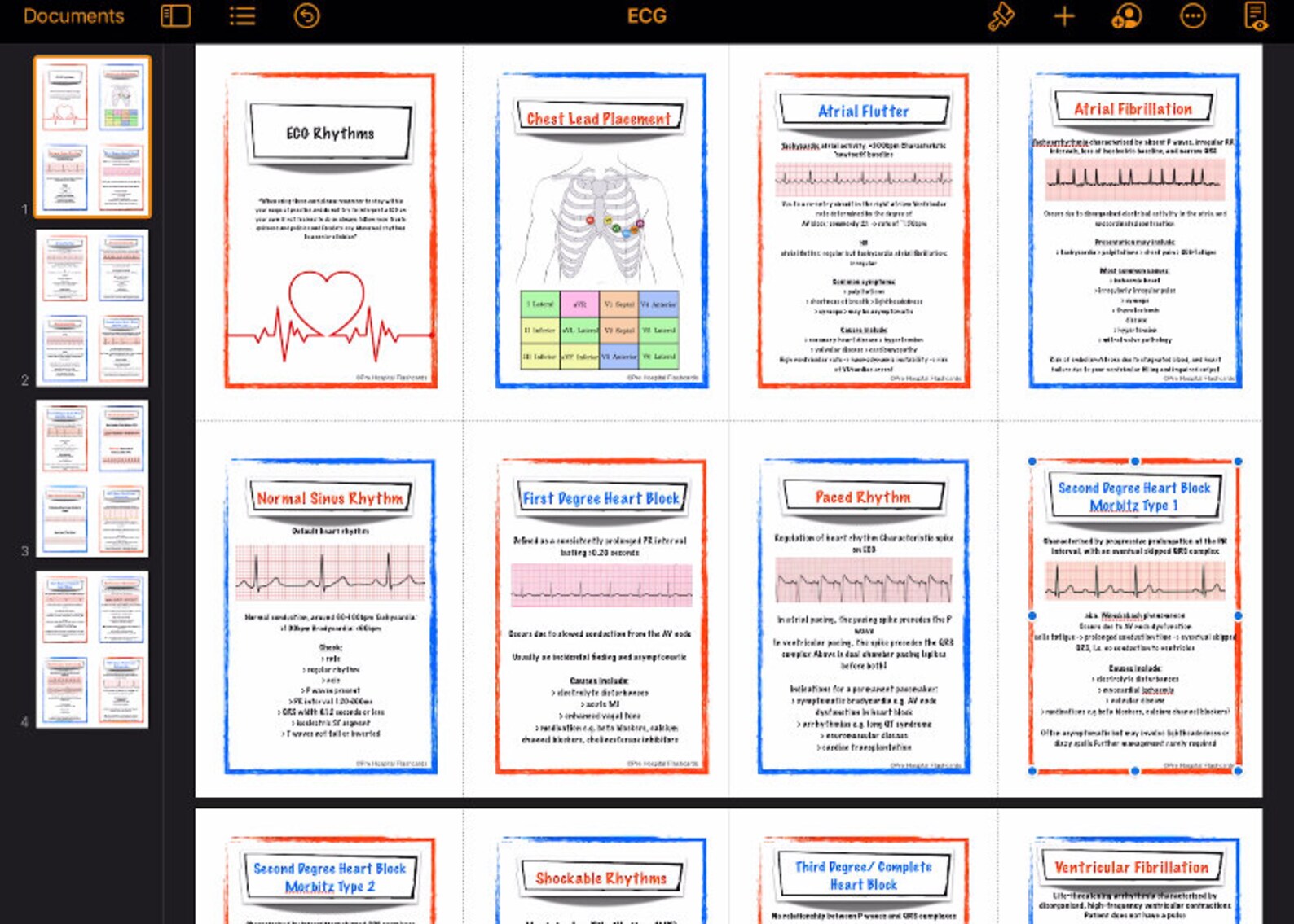 ECG Flashcards Download | Etsy