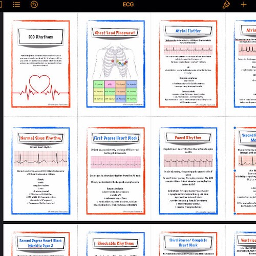 ECG Rhythms Flashcards PDF - Etsy India