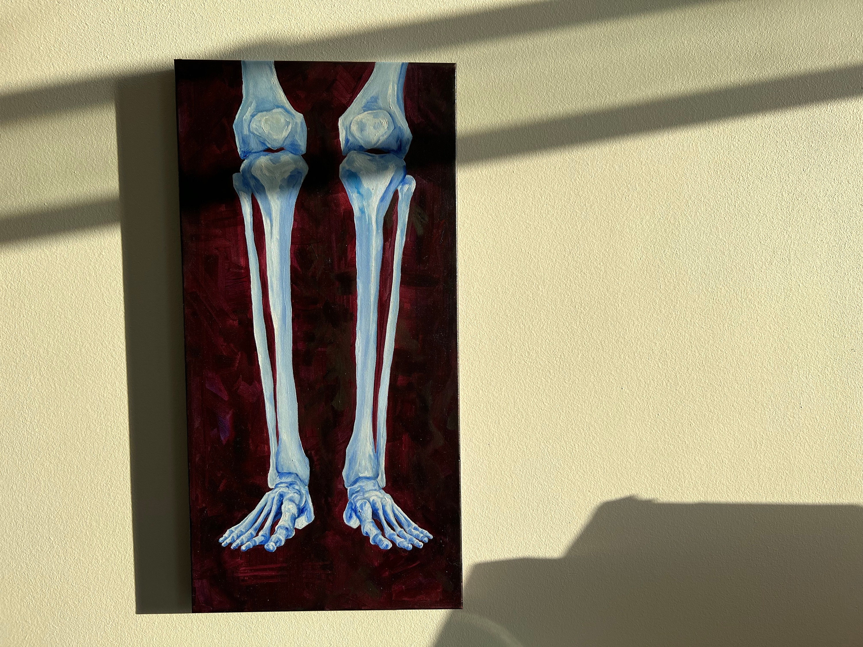 Original Oil Painting - Human Anatomy Leg Knee Bones Skeleton in Purple ...