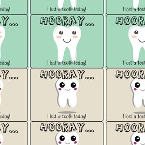 Circle OR Rectangle 'HOORAY I Lost My Tooth Today’ Stickers, Teacher ...