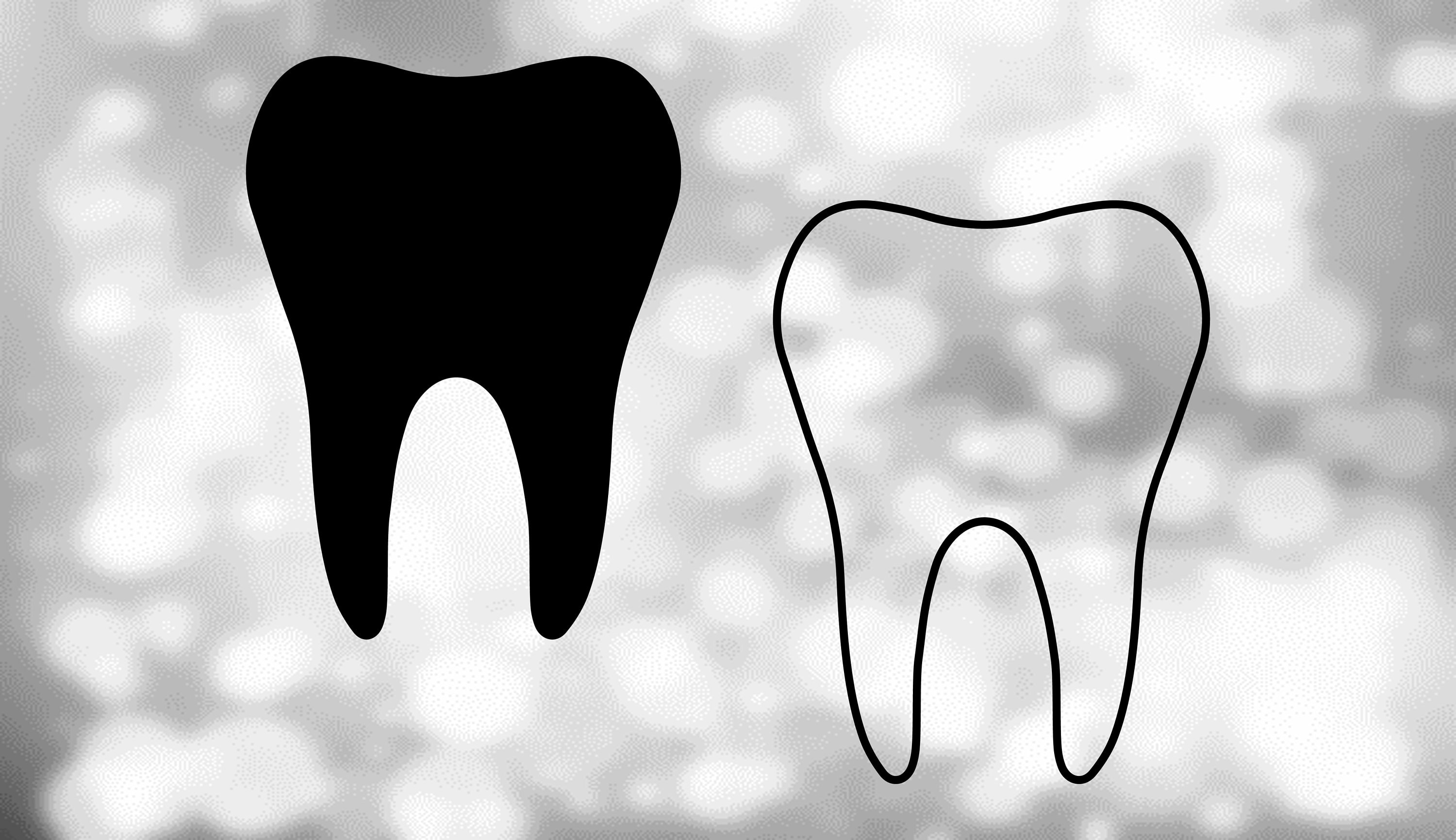 Medical Clipart: Simple Easy Human Molar Tooth in Black Solid - Etsy ...