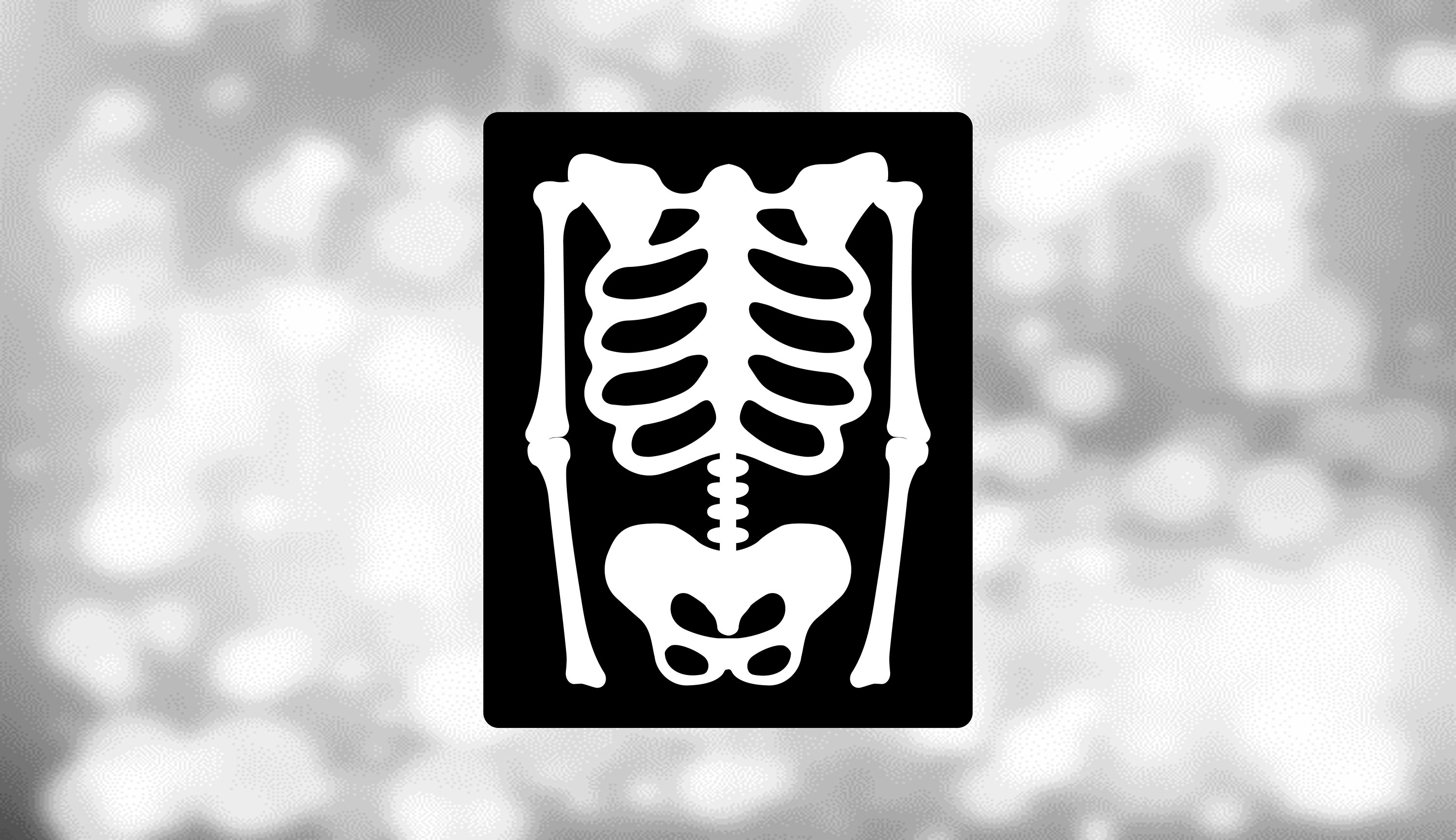Medical Clipart: White Skeleton X-ray of Torso or Upper Body - Etsy