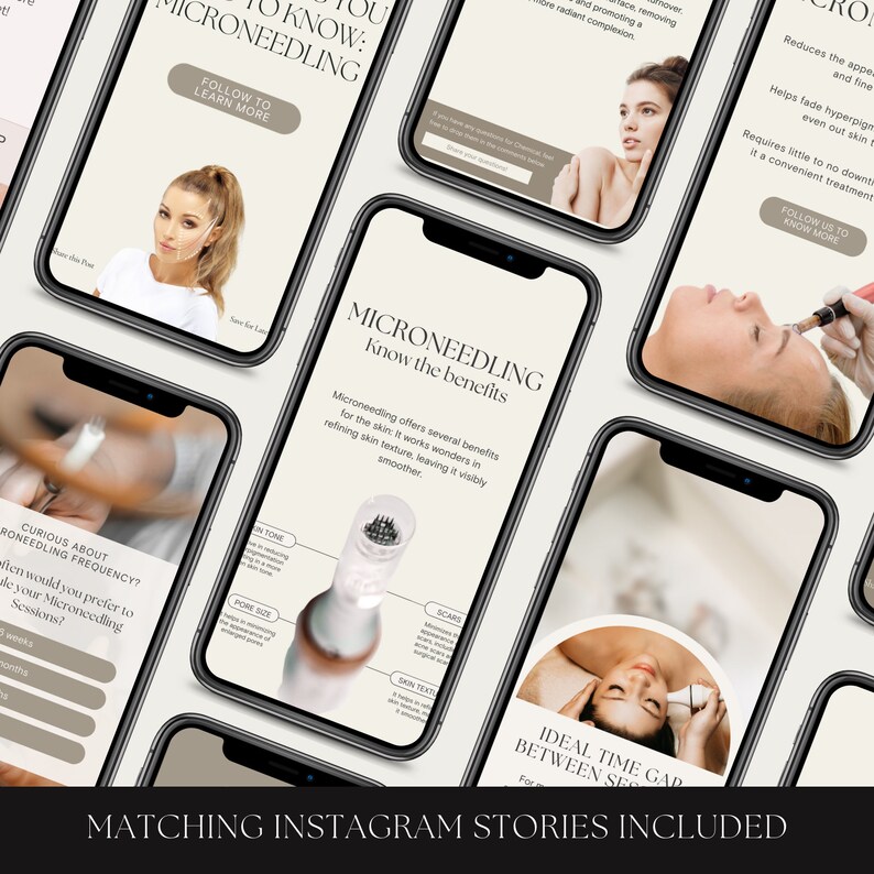 Microneedling Instagram Templates | Esthetician Social Media Templates ...