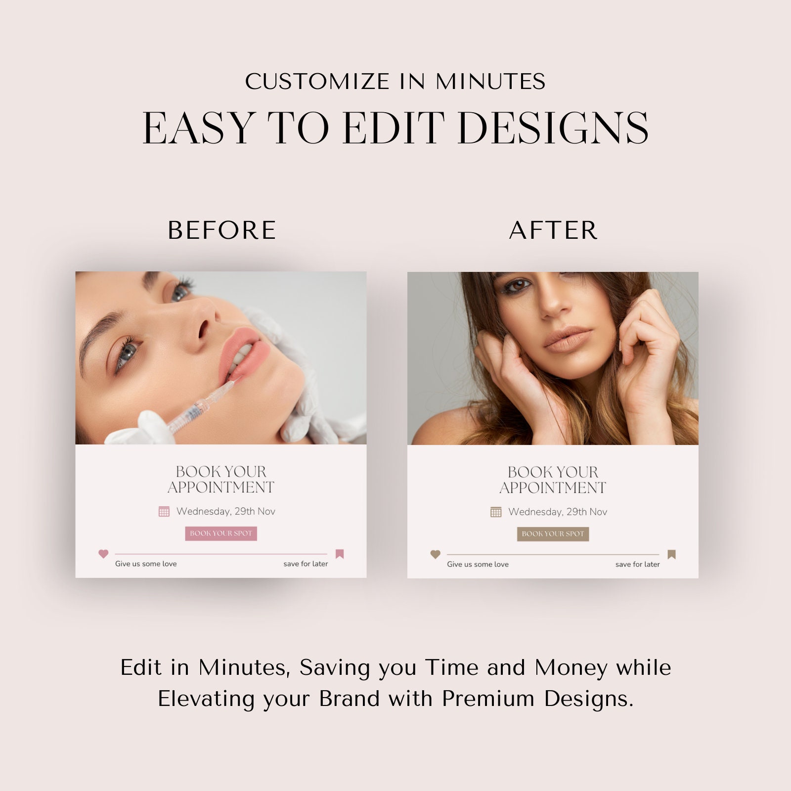 Pink Instagram Templates for Botox and Fillers | Nurse Injector ...