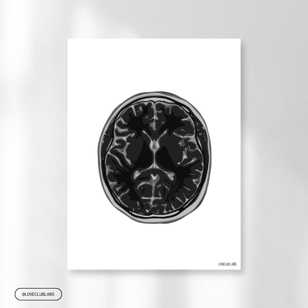 MRI Brain Scan Art Print | Neuroscience Art | Digital Illustration ...