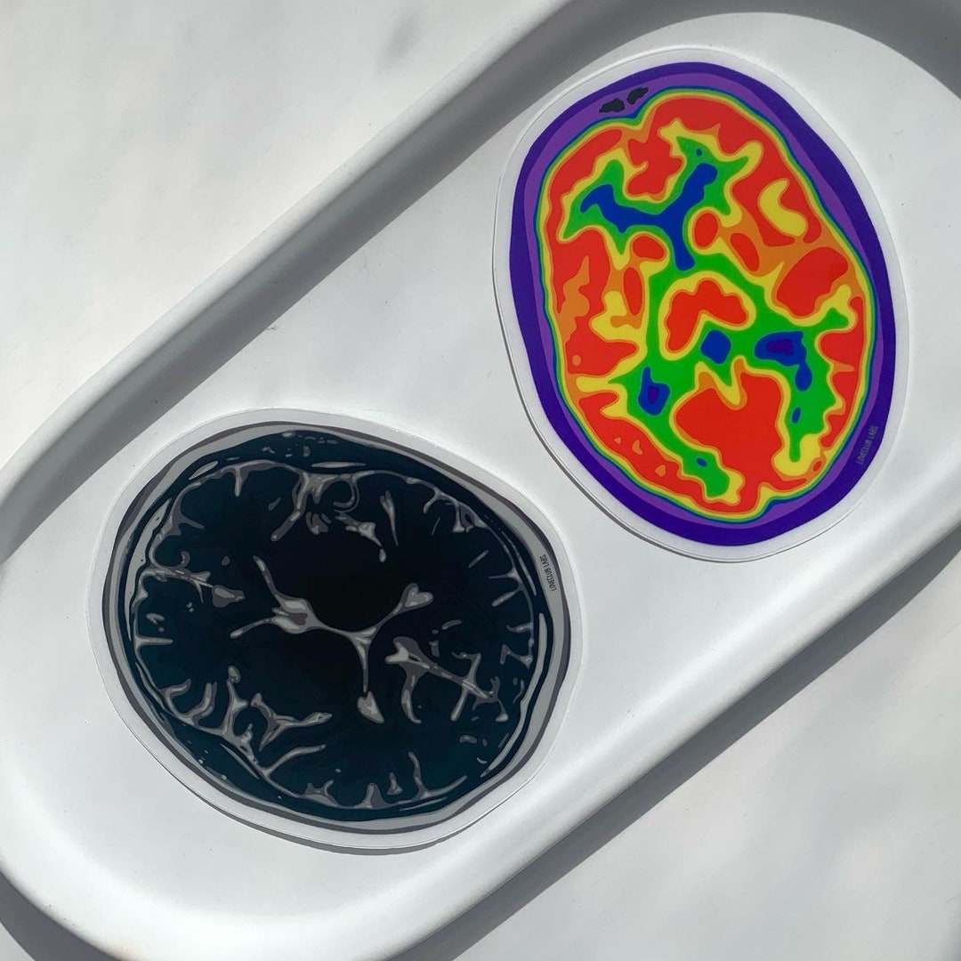 MRI + PET Brain Scan Anatomy Stickers | Brain Anatomy Stickers | Brain ...
