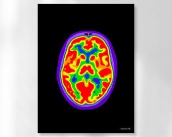 Brain Scan Art - Etsy