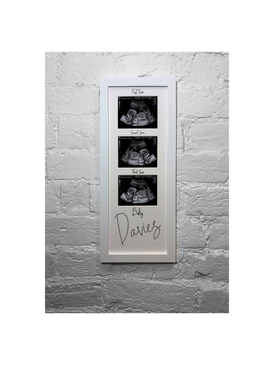 Personalised Ultrasound Baby Scan Photo Frame 3 Aperture Pregnancy ...