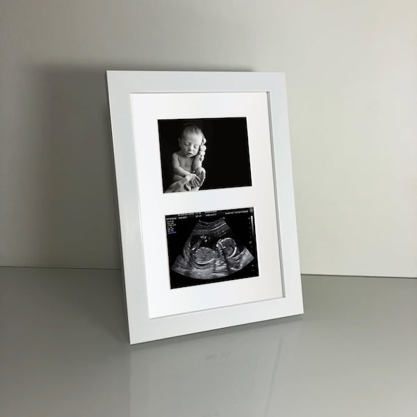 Ultrasound Frame - Etsy