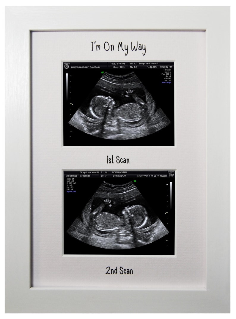 Baby Scan Photo Frame I'm on My Way 2 Aperture First - Etsy