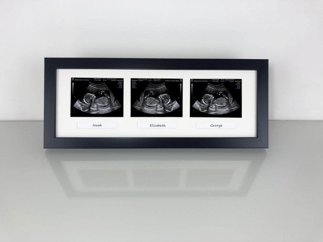 Personalised Ultrasound Baby Scan 3 Photo Frame Multi Aperture ...