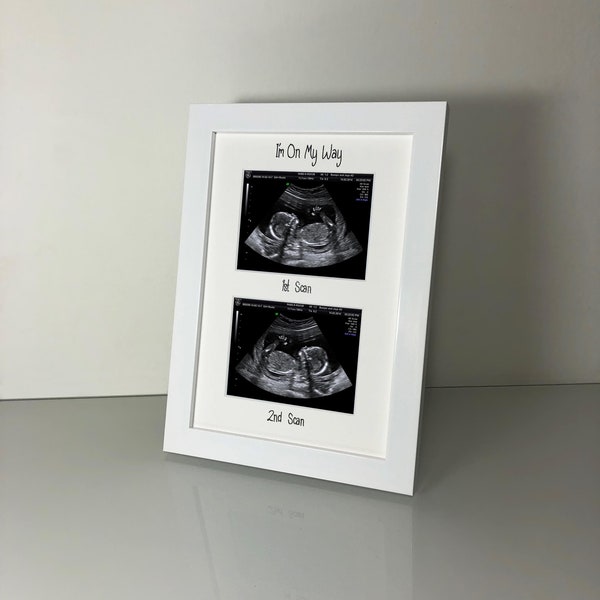 Ultrasound Frame - Etsy