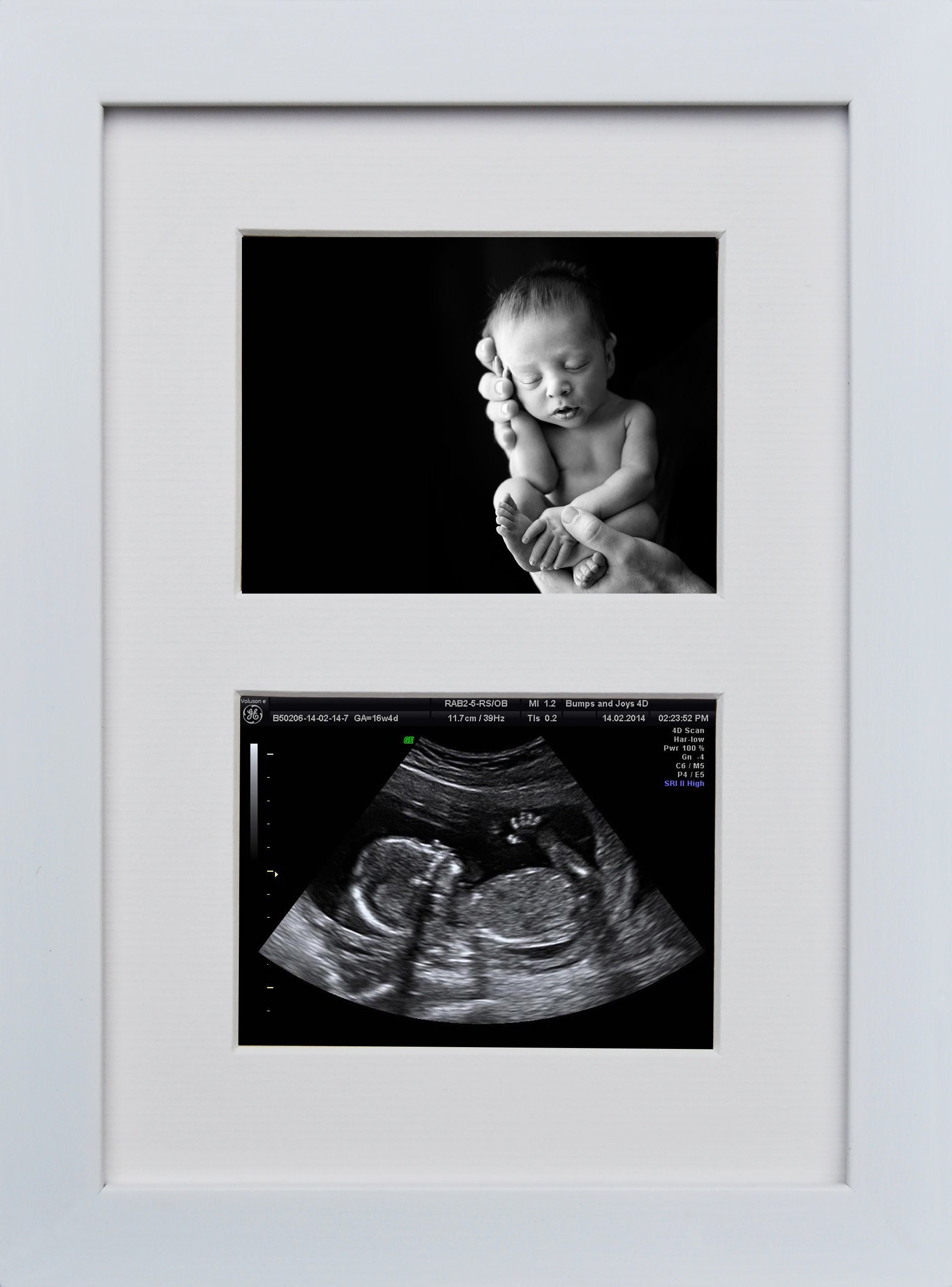 Baby Scan Photo Frame 2 Aperture Ultrasound Sonogram 12 & 20 Week ...