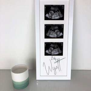 Personalised Ultrasound Baby Scan Photo Frame 3 Aperture Pregnancy ...