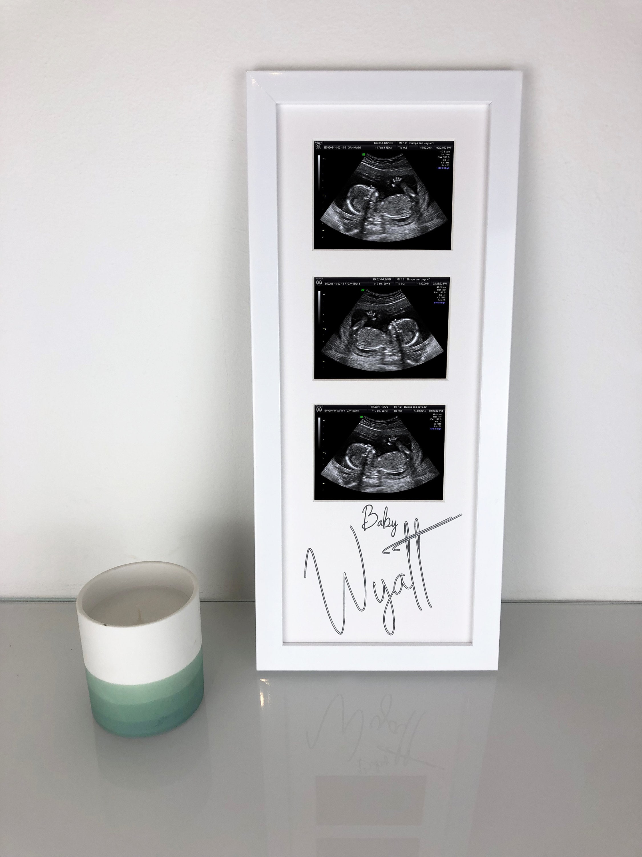 Personalised Ultrasound Baby Scan Photo Frame 3 Aperture Pregnancy ...