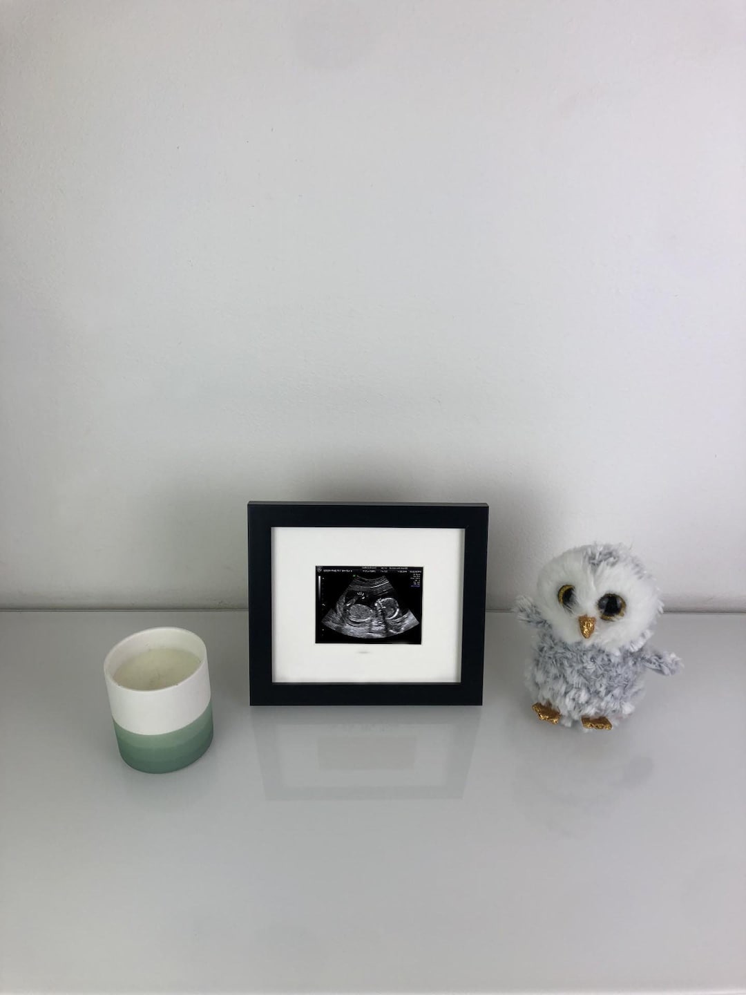 Baby Scan Photo Frames - Ultrasound Sonogram 12 & 20 Week Pregnancy ...
