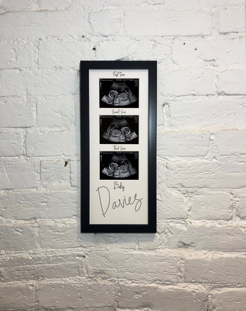 Personalised Ultrasound Baby Scan Photo Frame 3 Aperture Pregnancy ...