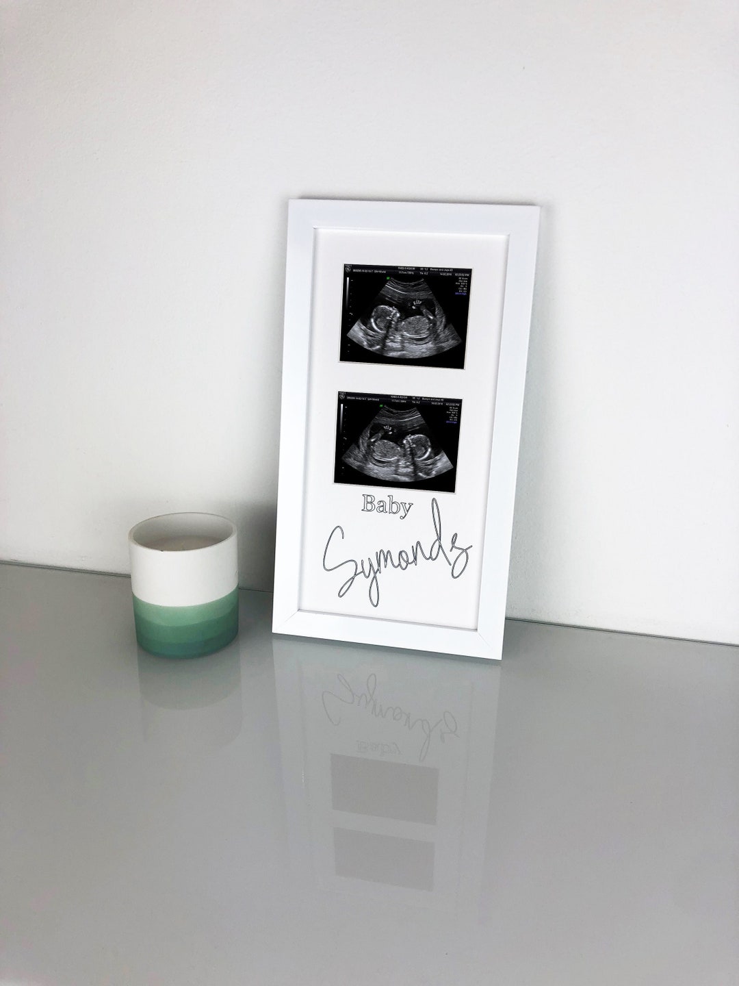 Personalised Ultrasound Baby Scan Print 2app Pregnancy Picture Photo ...