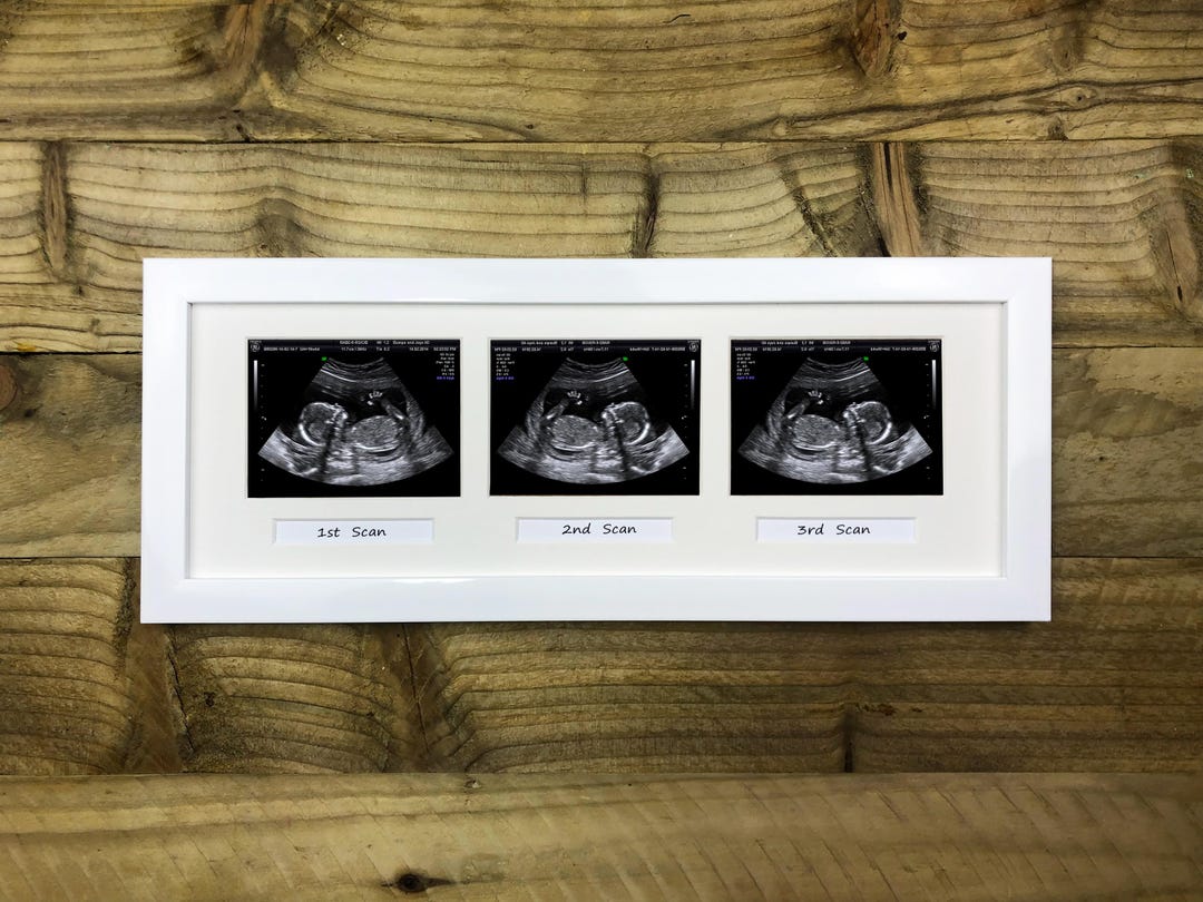 Personalised Ultrasound Triple Baby Scan 3 Photo Frame - Multi Aperture ...