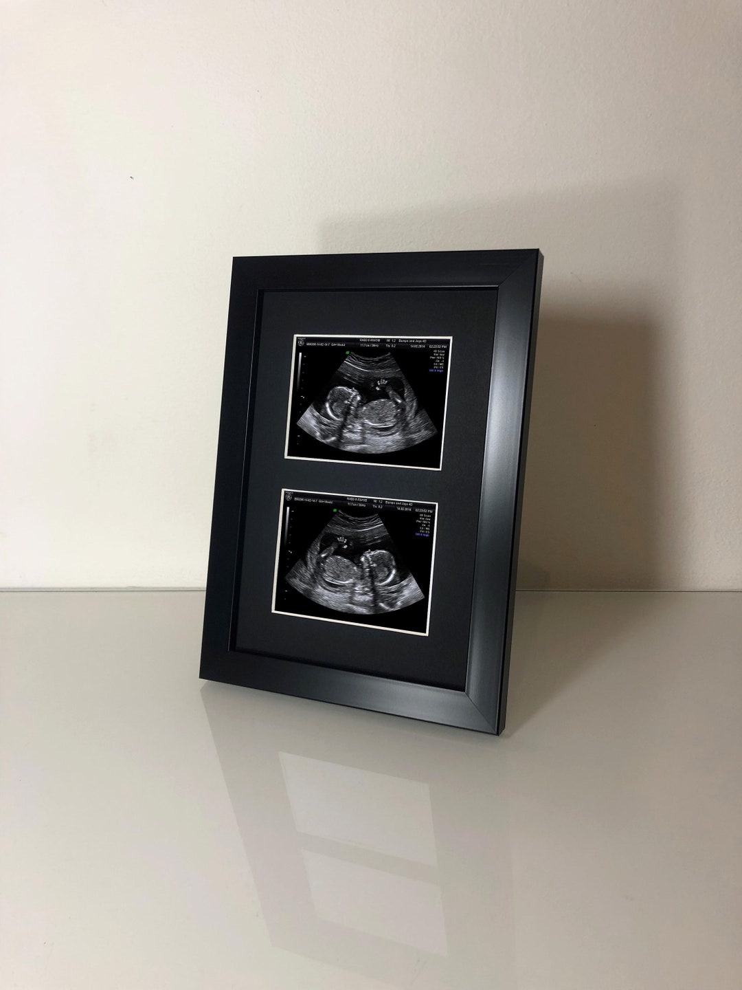 Baby Scan Photo Frame 2 Aperture Ultrasound Sonogram 12 & 20 Week ...