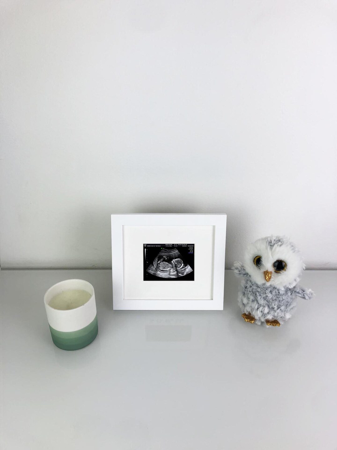 Baby Scan Photo Frame - Ultrasound Sonogram 12 & 20 Week Pregnancy ...