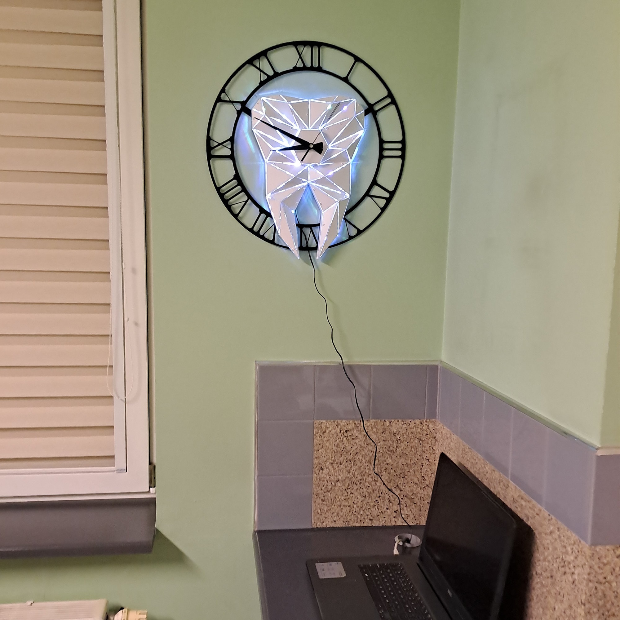 3D Dentist Metal Wall Clock, Dentist Office Decor, Dental Wall Art ...