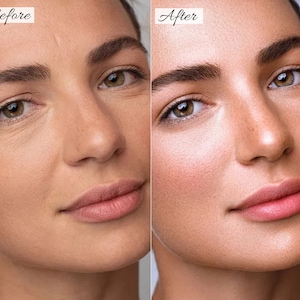 Advanced Photo Retouching Service | Photo Edit Face | Scar Removal ...