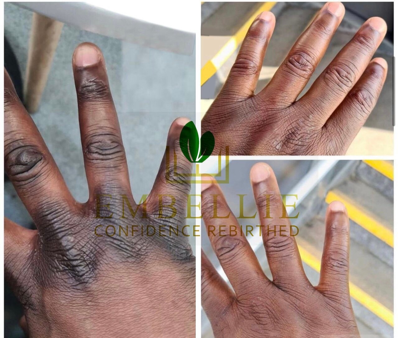 Dark Knuckle and Feet Cream - Etsy