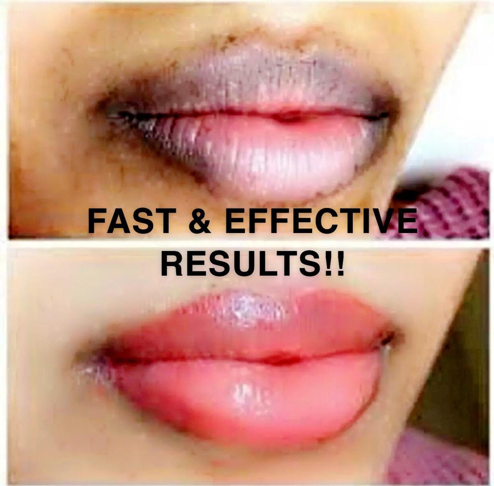 EXTREME PINK Lip LIGHTENING Scrub Solution Permanent Pink | Etsy