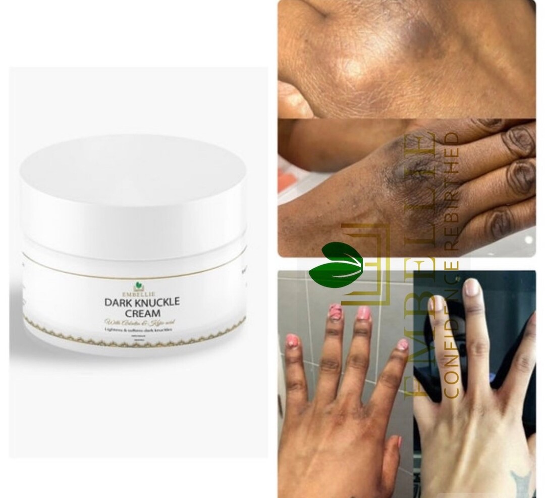 Dark Knuckle and Feet Cream - Etsy