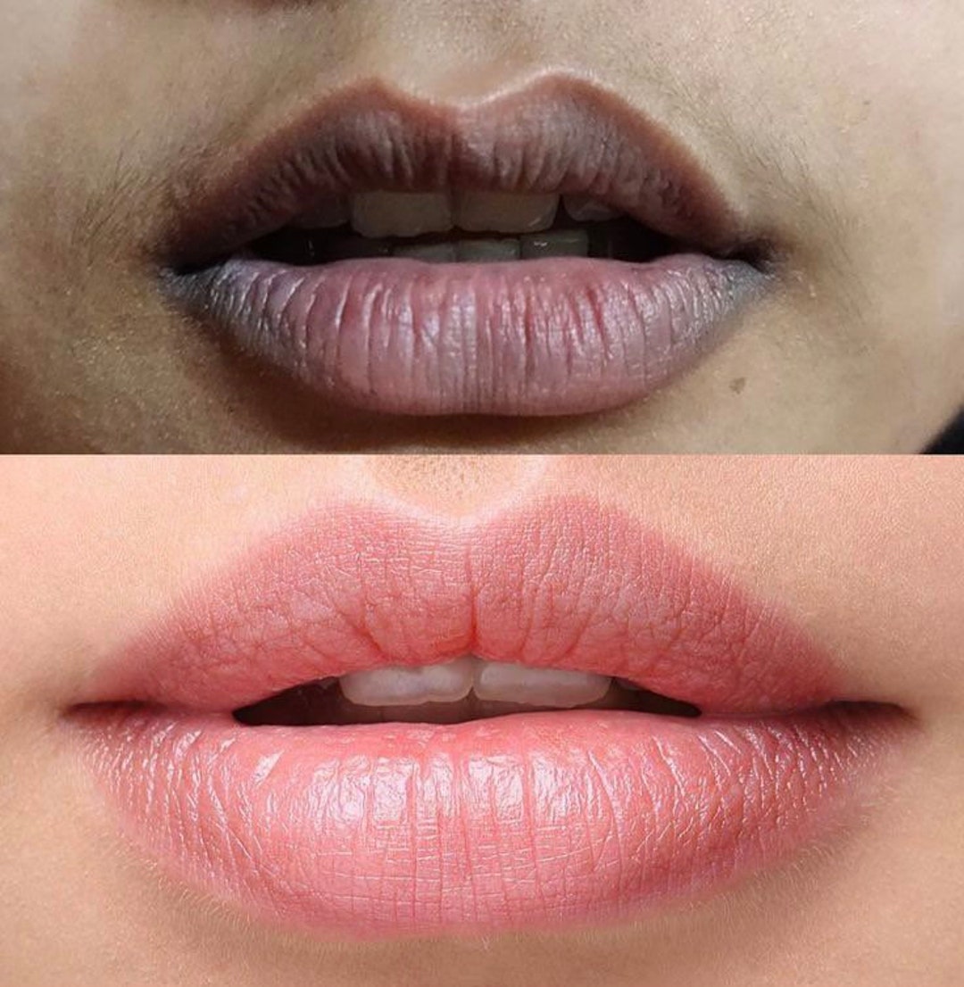 EXTREME PINK Lip BRIGHTENING Balm Solution Permanent Pink Lip Dark Lip ...