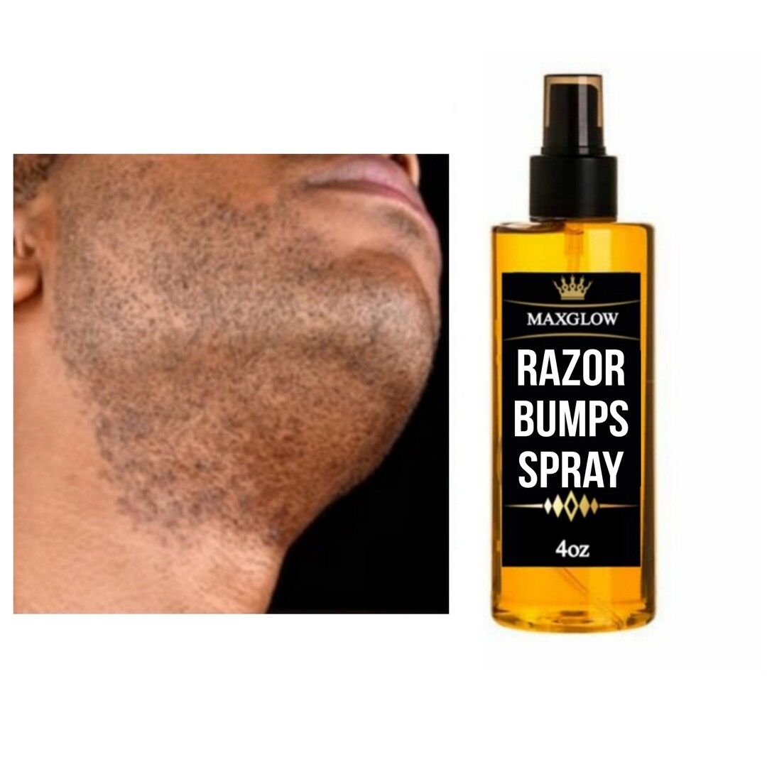 Razor Bumps Spray, Beard , Head, Bikini Area - Etsy Canada