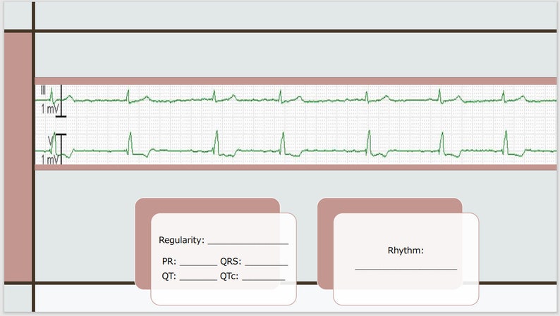 ECG / EKG Practice Book - Etsy