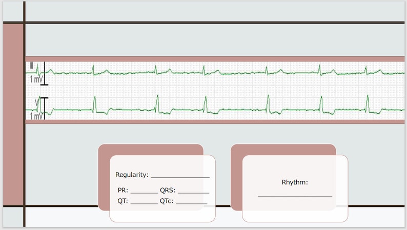 Combo - ECG/EKG Practice Book and 7 Steps to ECG Interpretation - Etsy