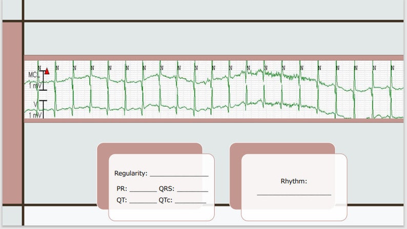 ECG / EKG Practice Book - Etsy