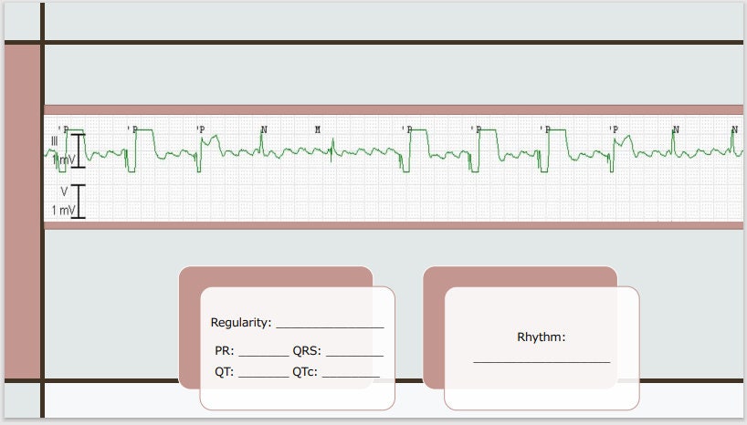 ECG / EKG Practice Book - Etsy