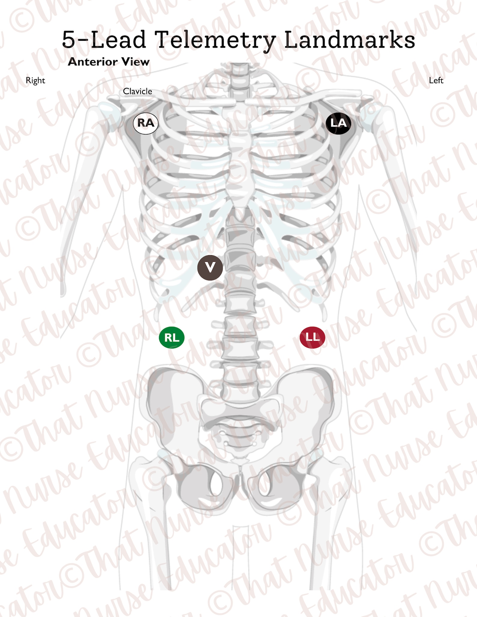 ECG Lead Placement Activity for 12-lead 15-lead and 5-lead Plus Bonus ...