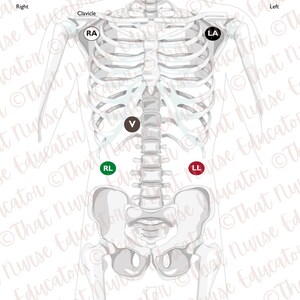 ECG Lead Placement Activity for 12-lead 15-lead and 5-lead Plus Bonus ...