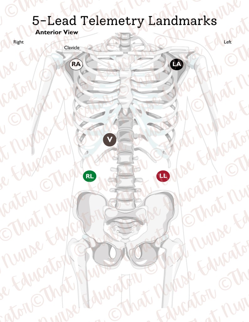 ECG Lead Placement Activity for 12-lead 15-lead and 5-lead Plus Bonus Heart Auscultation ...